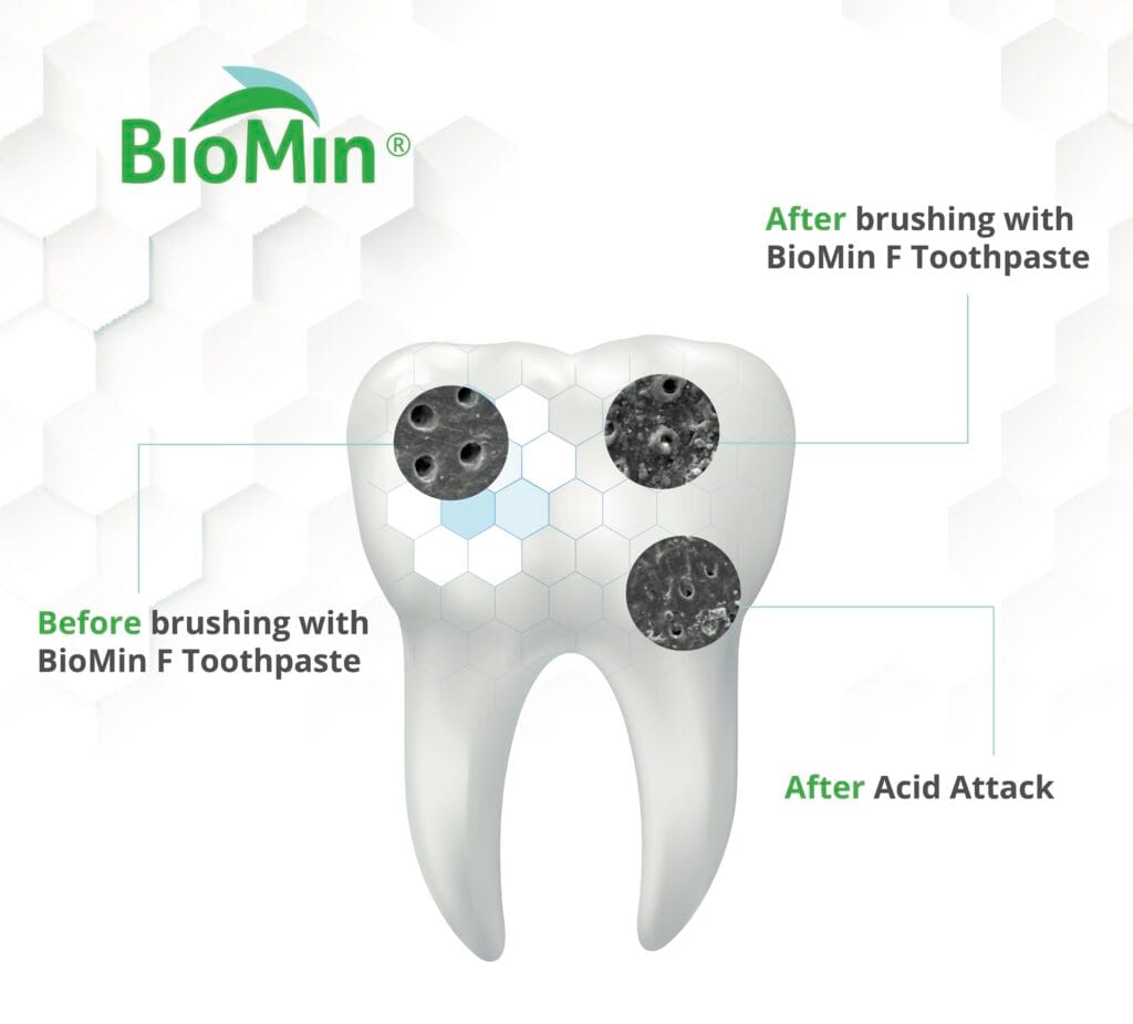 BioMin® F: Award winning toothpaste, clinically proven to deliver ...