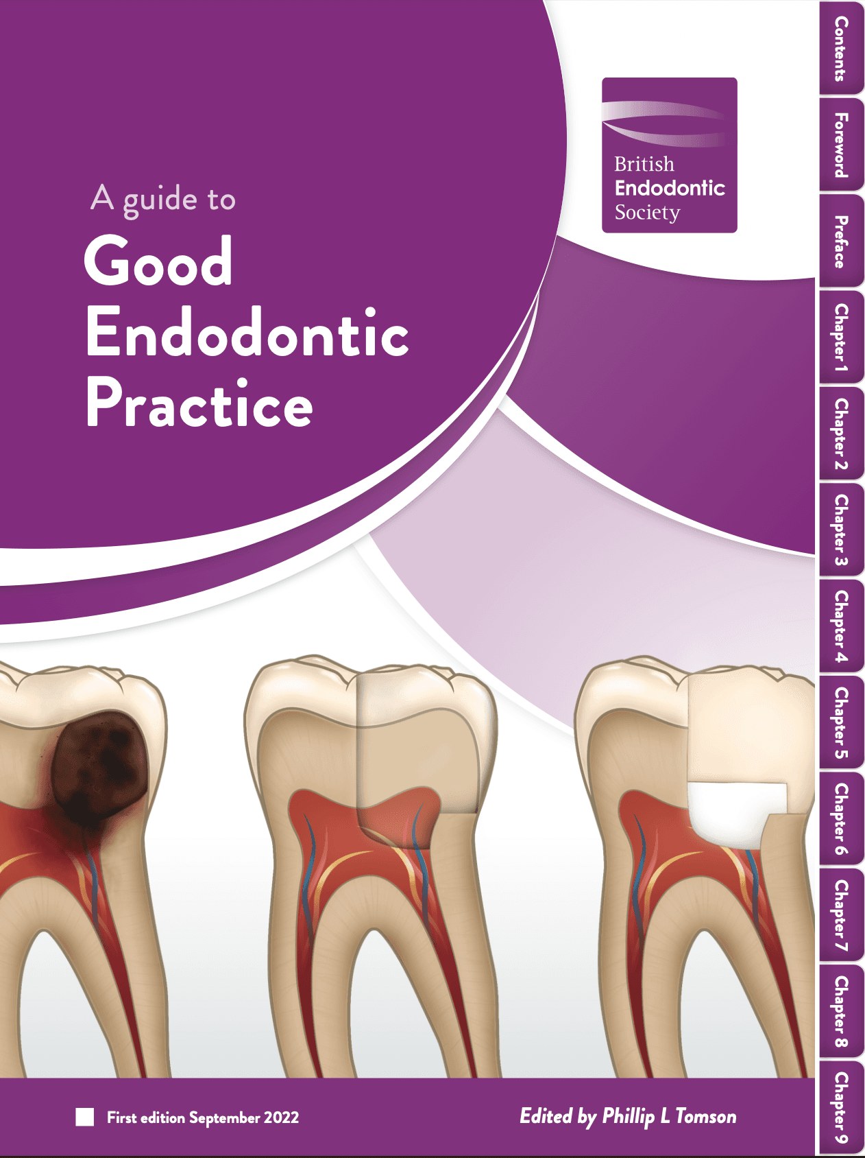 Anaesthetic failure in irreversible pulpitis: strategies for the ...